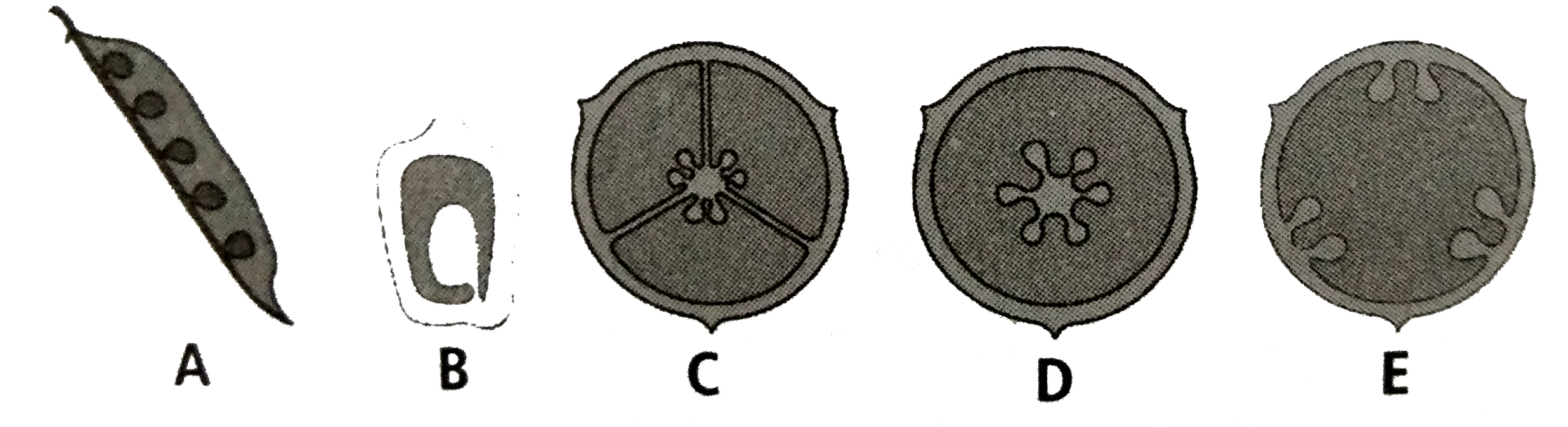 Indentify the different types of placentation shown in figure and ...