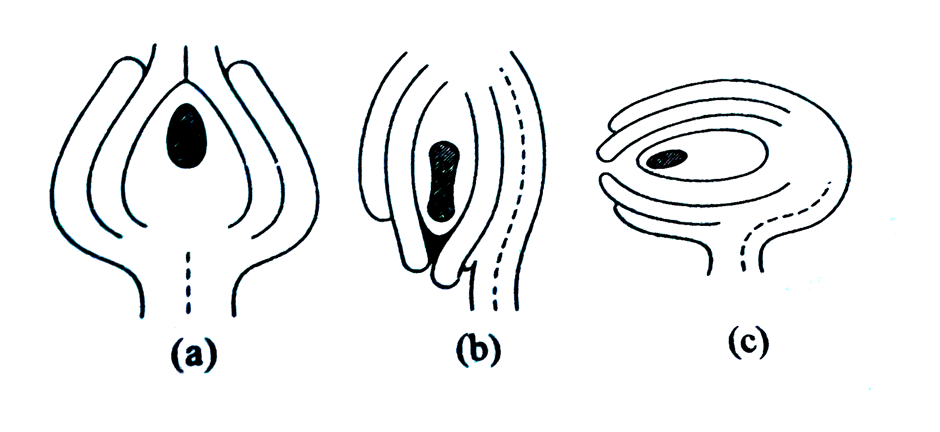 Ovule is inverted with body fused to funicle, micropyle lying close to ...