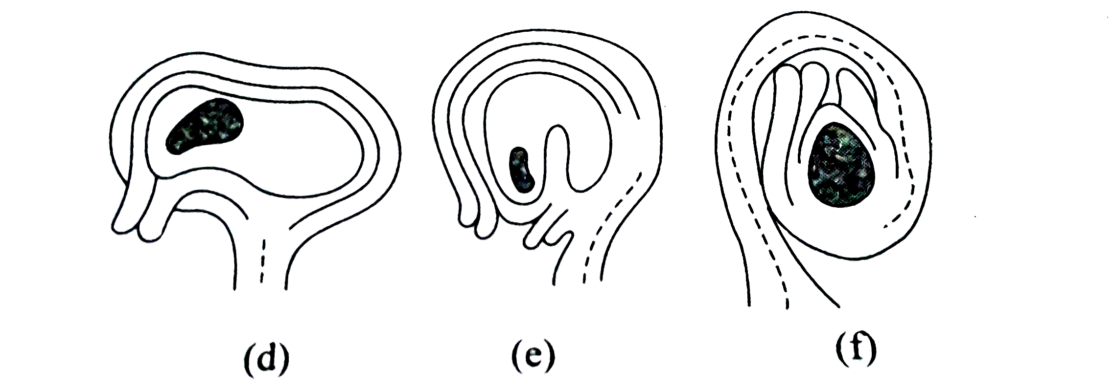 Ovule is inverted with body fused to funicle, micropyle lying close to ...